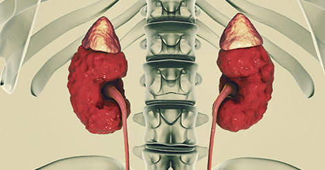 Creatinine Stages and Risks at Each Stage - Full Body Check
